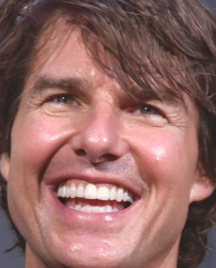 Celebrities With Crooked Teeth: Katy Perry, Rachel Weisz, and More | In ...
