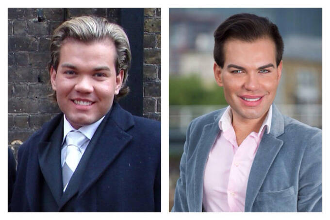 Human Ken Before And After