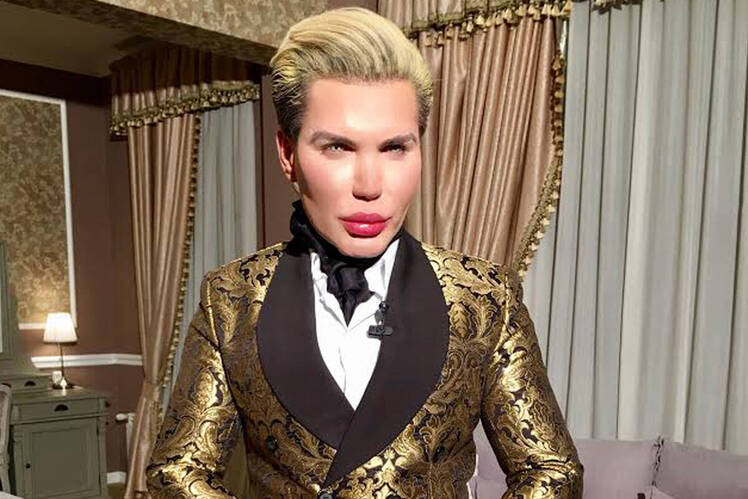 Botched Rodrigo Before and After: "Human Ken Doll" Flaunts New ...